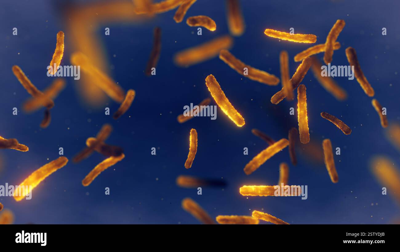 Tuberculosis (TB) is a pulmonary infectious disease,aka consumption, a ...