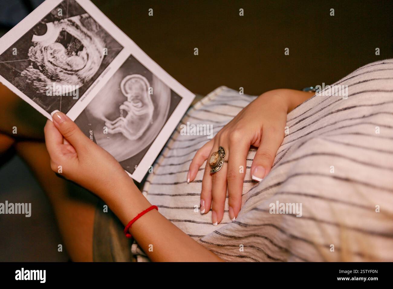 Gynecologist check. Pregnant belly with ultrasound result picture ...