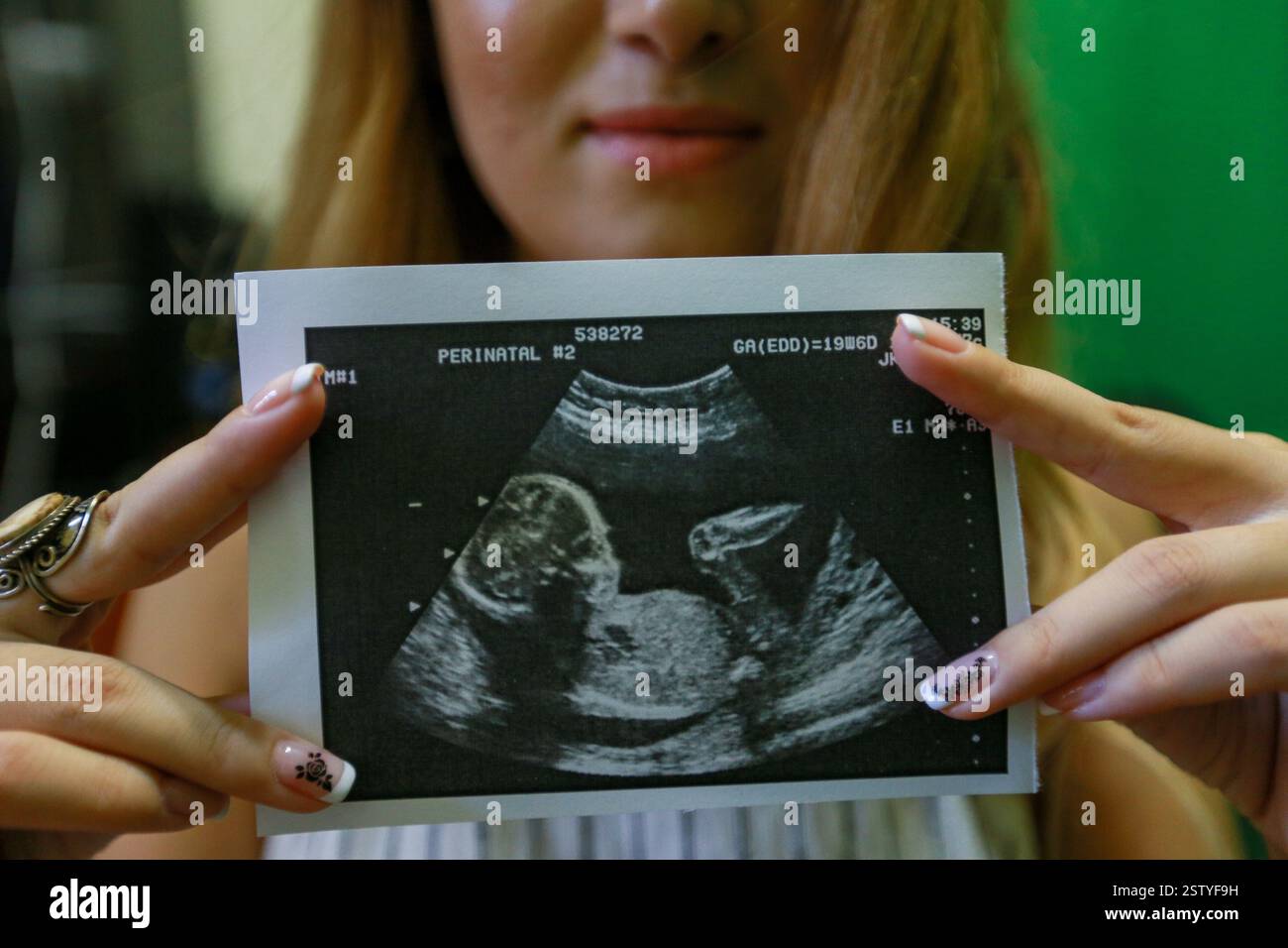 Gynecologist check. Pregnant belly with ultrasound result picture ...