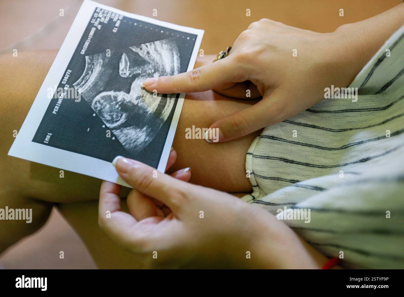 Gynecologist check. Pregnant belly with ultrasound result picture ...