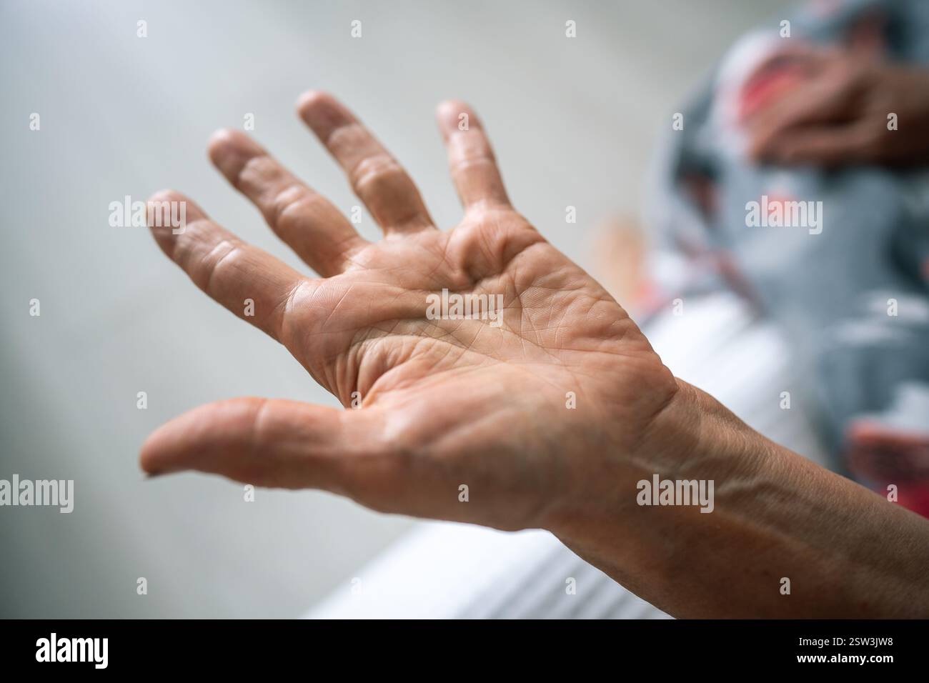 Hand tendon disease. Cropped woman hand with dense node under finger ...