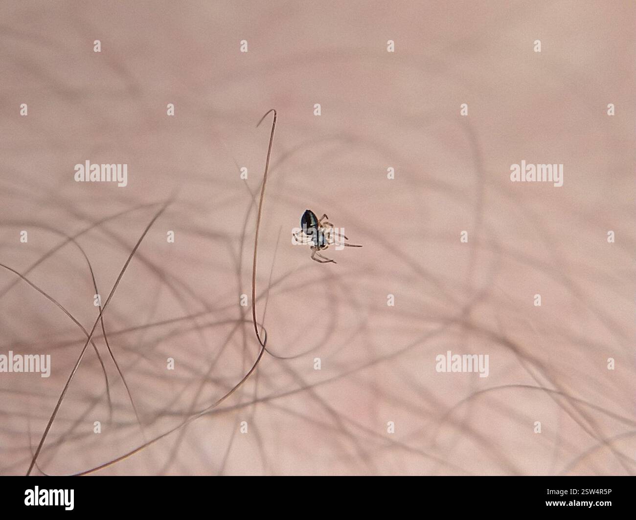 Dwarf Spiders (Erigoninae), Arachnida, California State University ...