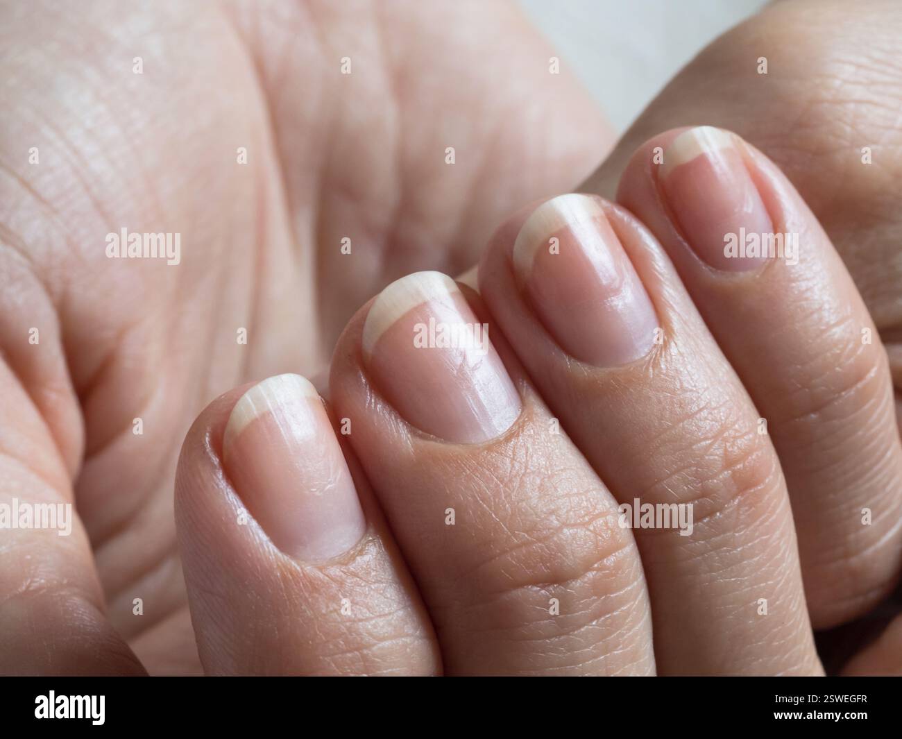 Nails damaged hi-res stock photography and images - Alamy
