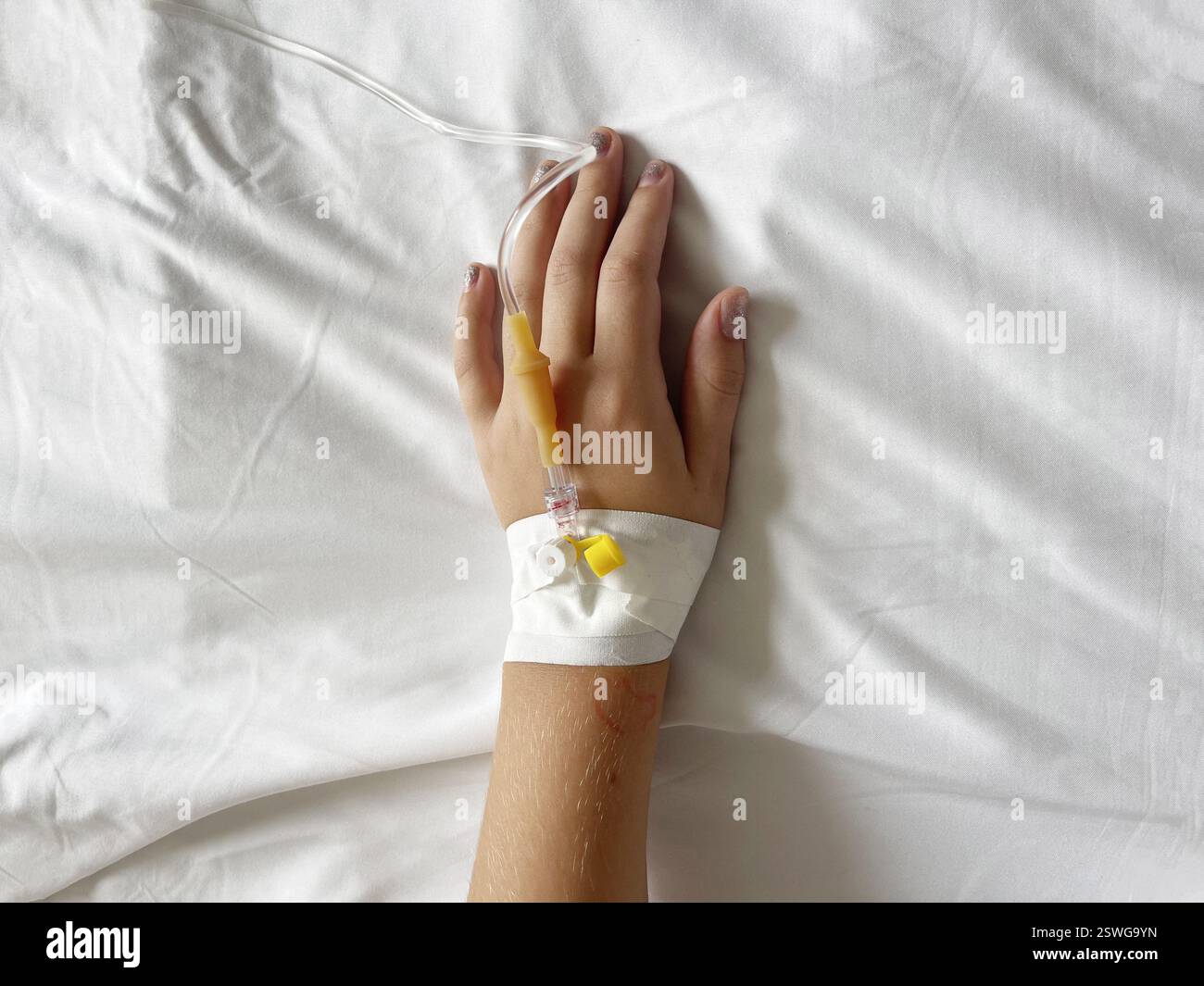 Close up IV drip in female hand in hospital bed. Hospital Iv Drip and ...