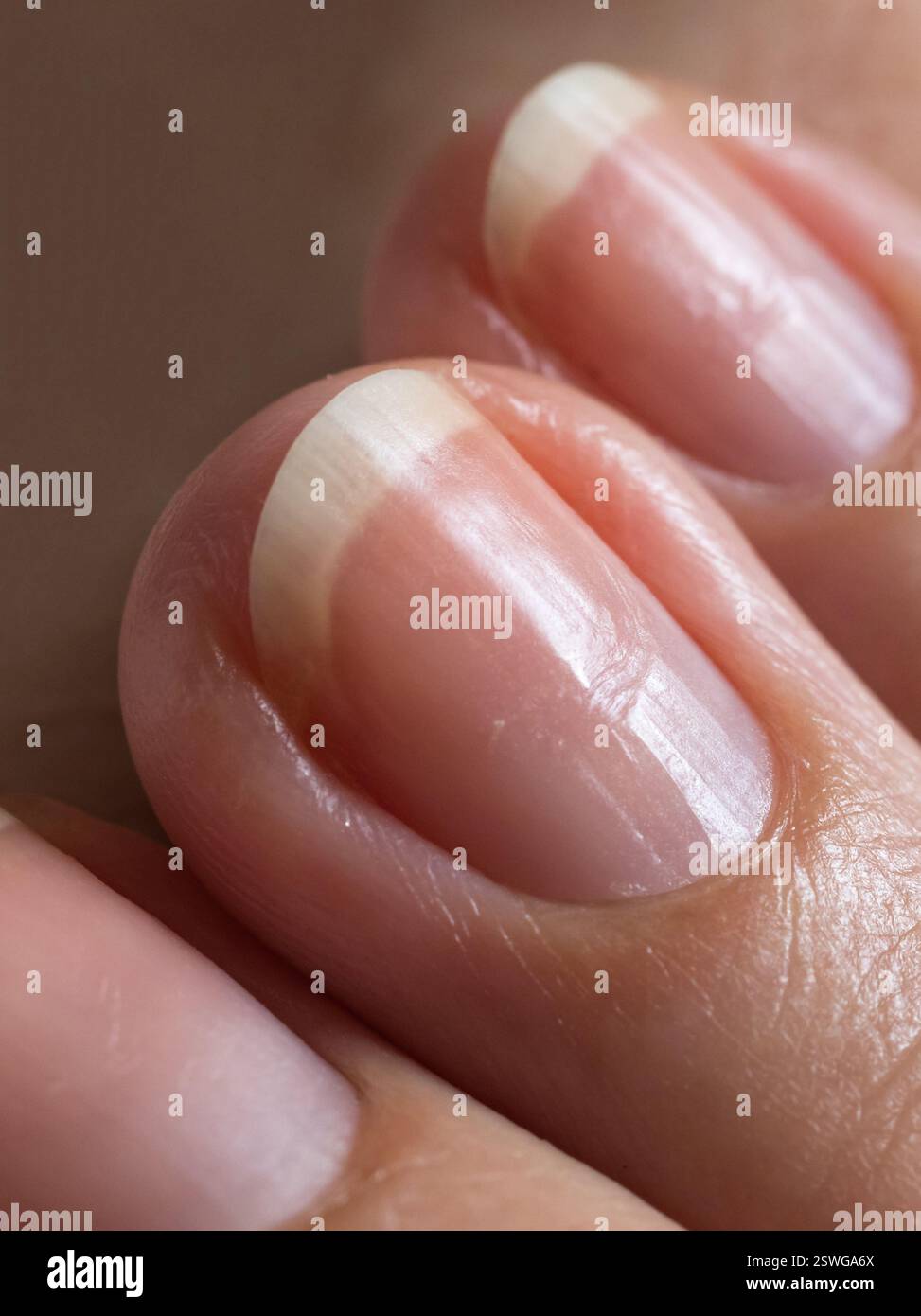 Pitting nails hi-res stock photography and images - Alamy