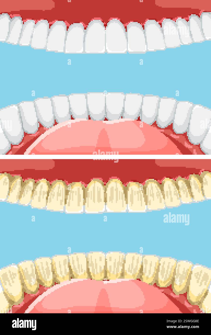 Illustration showing teeth health and plaque buildup Stock Vector Image ...