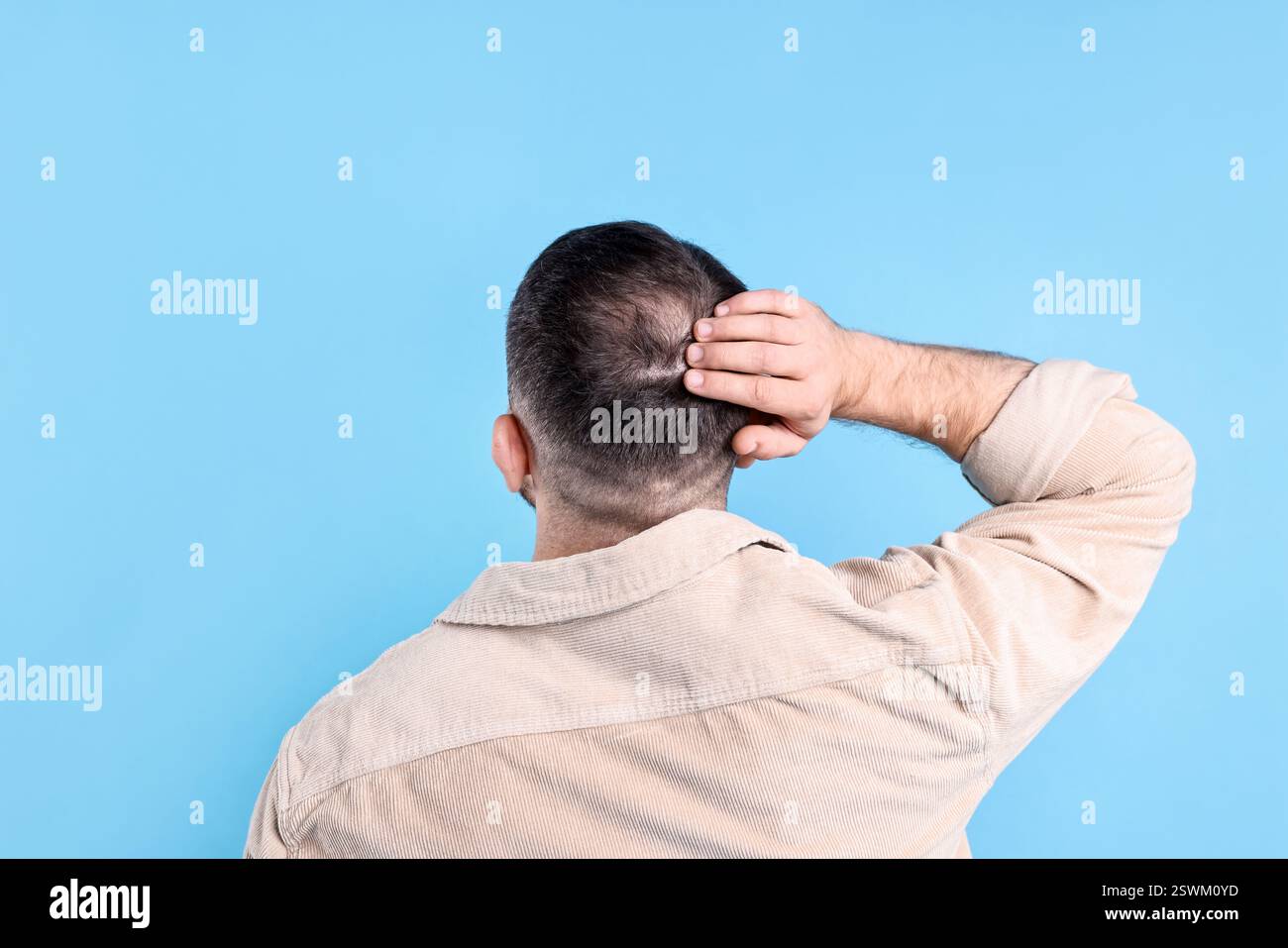 Baldness problem. Man with bald spot on light blue background, back ...