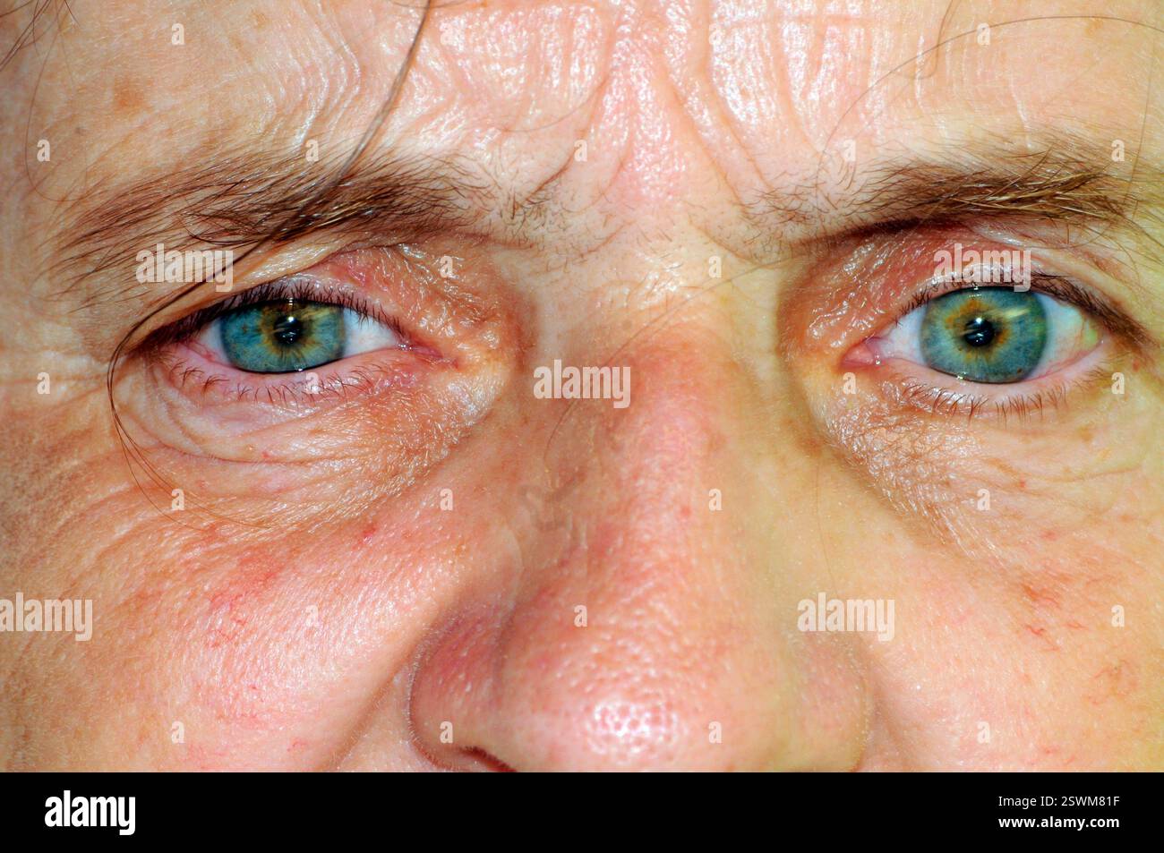 the human eye, the sense organ for the visual perception eye,organ for ...