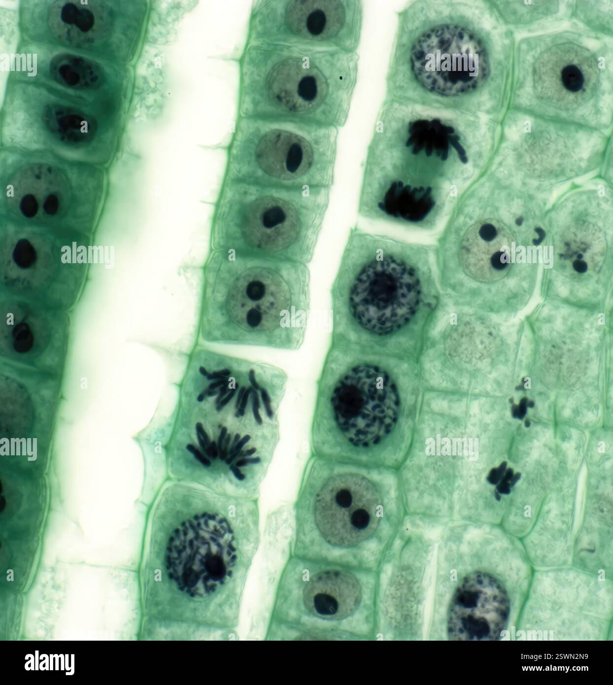 Plant cell mitosis. Light micrograph of root tip cells from an onion ...