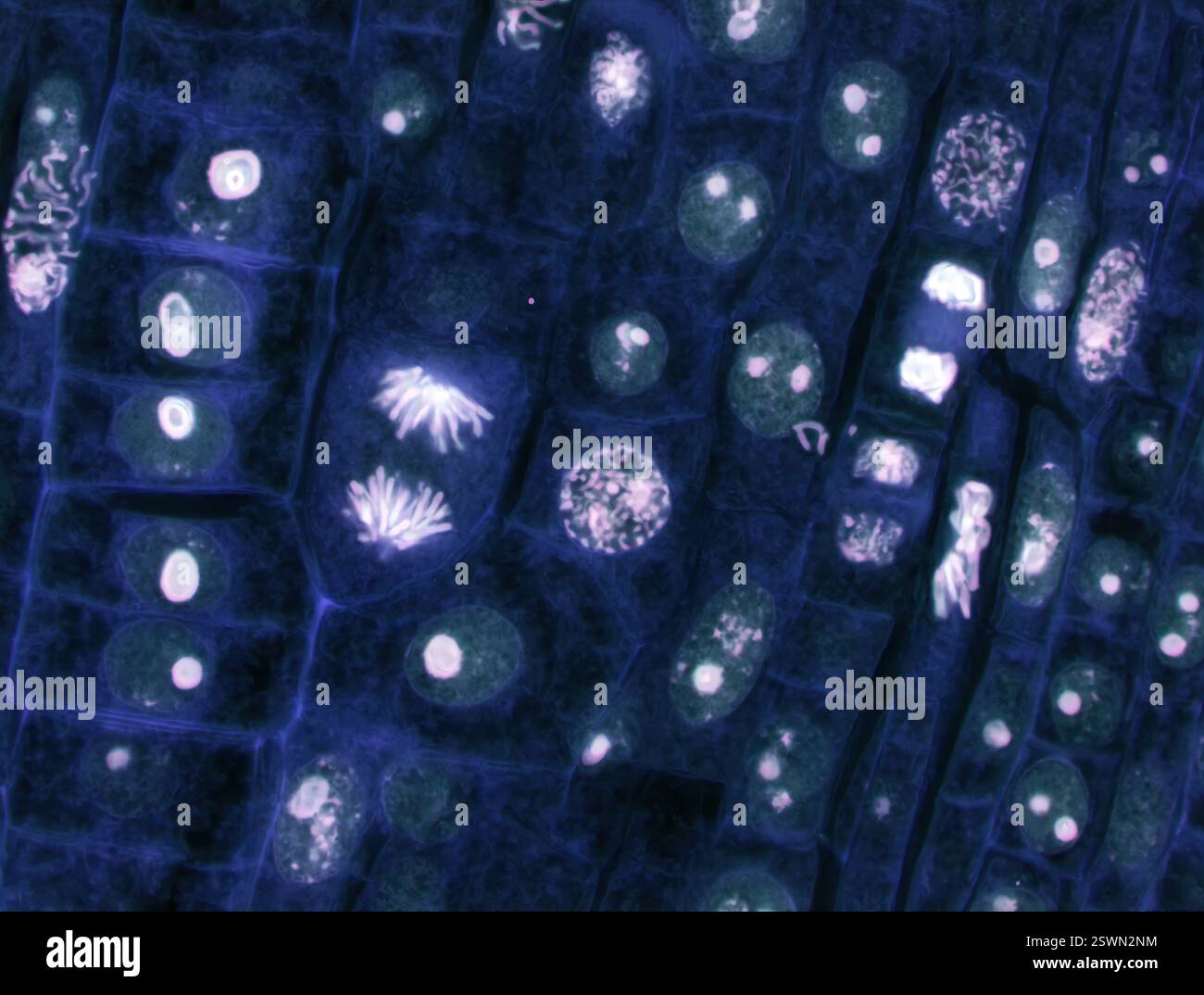 Plant cell mitosis. Light micrograph of root tip cells from an onion ...
