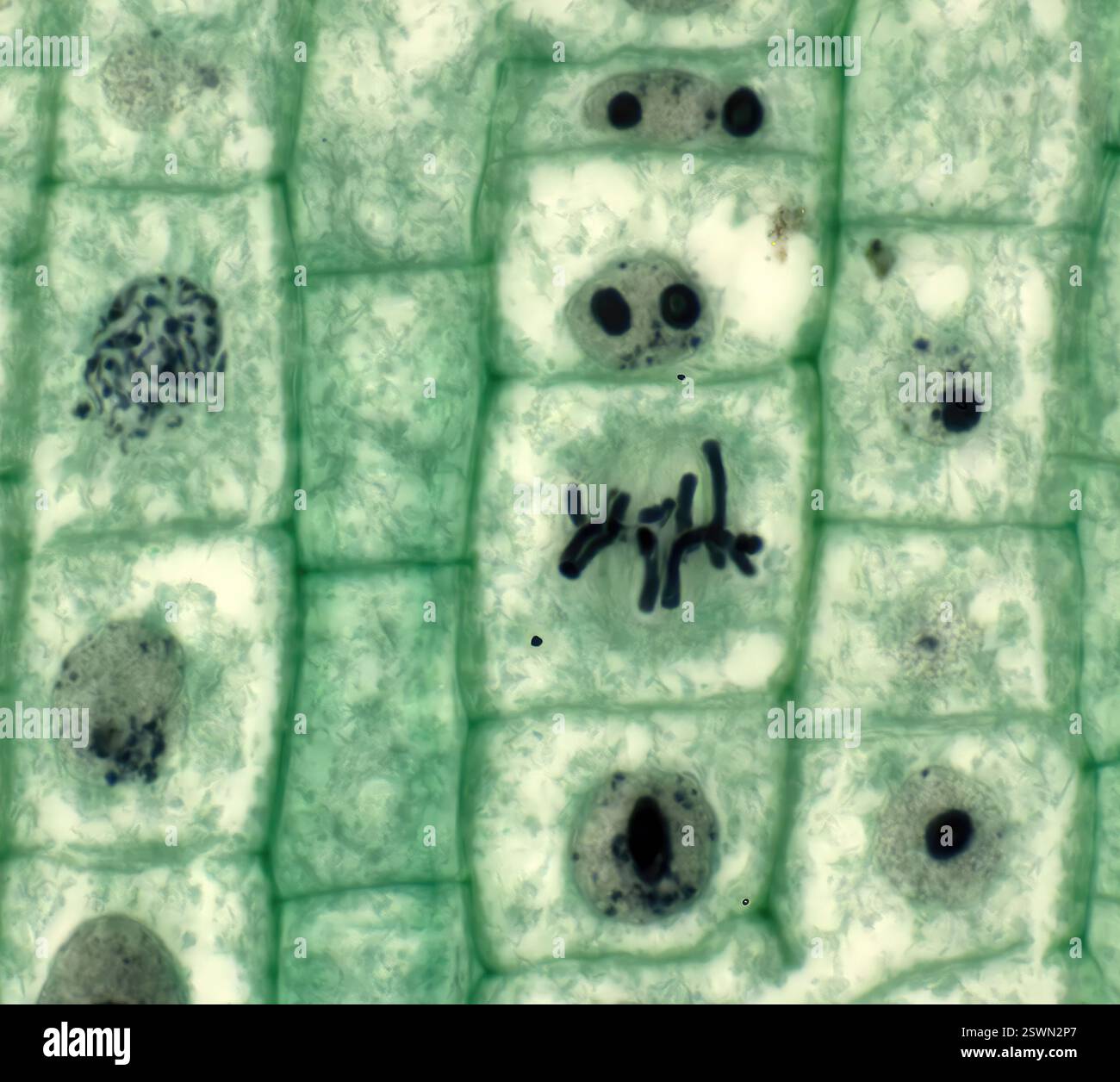 Plant cell mitosis. Light micrograph of root tip cells from an onion (Allium sp.) undergoing ...