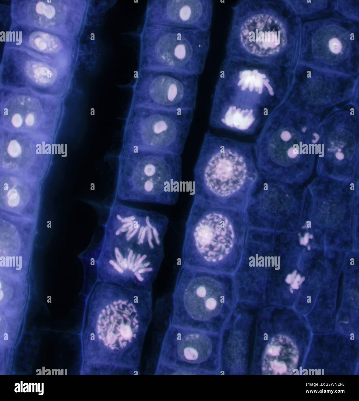 Plant cell mitosis. Light micrograph of root tip cells from an onion ...