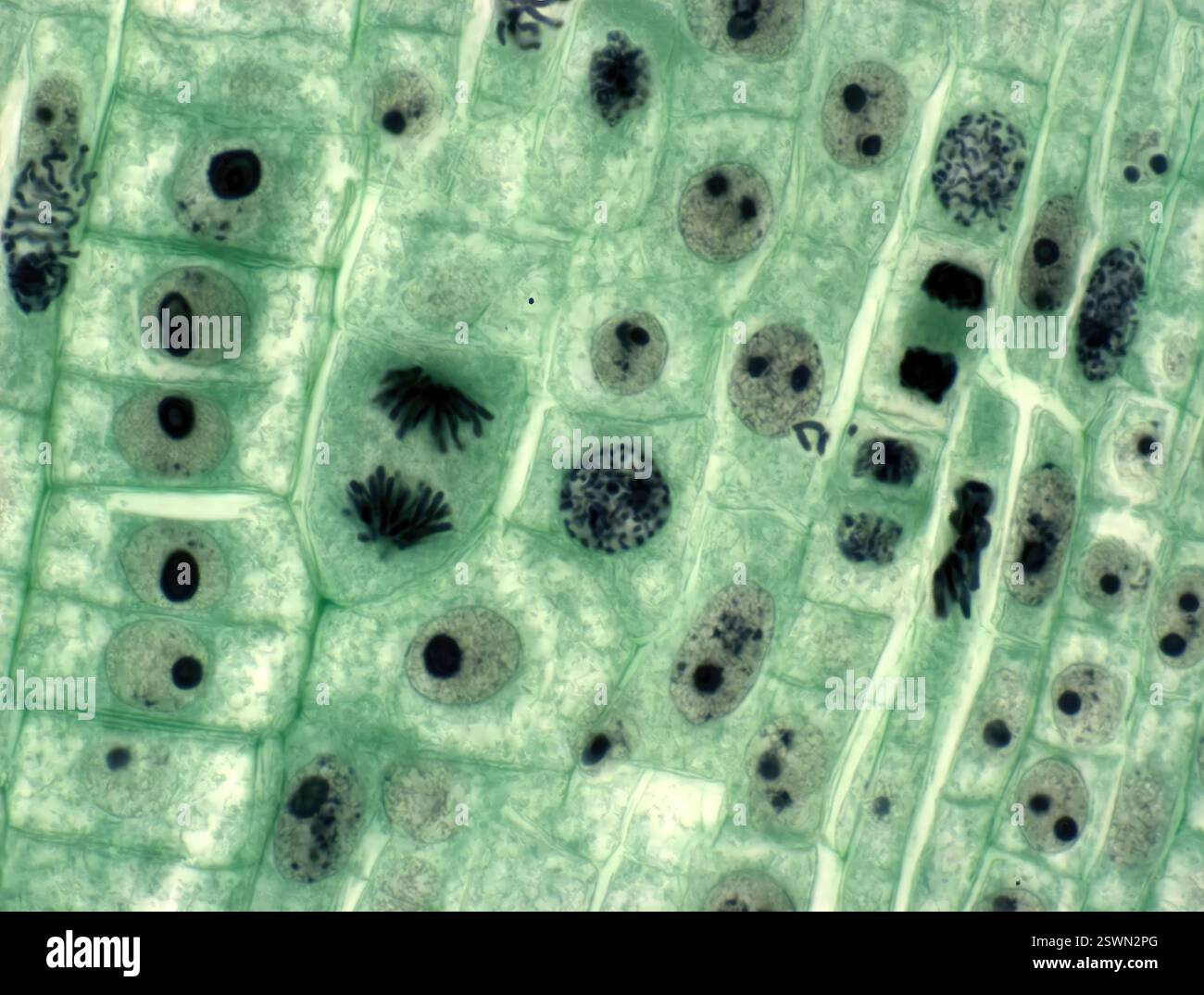 Plant cell mitosis. Light micrograph of root tip cells from an onion ...