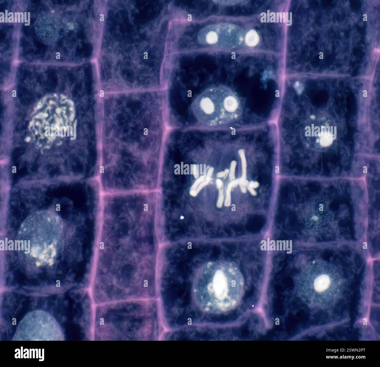 Plant cell mitosis. Light micrograph of root tip cells from an onion (Allium sp.) undergoing ...