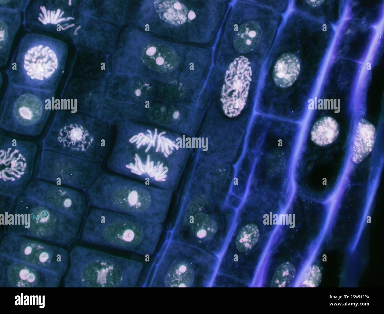 Plant cell mitosis. Light micrograph of root tip cells from an onion (Allium sp.) undergoing ...