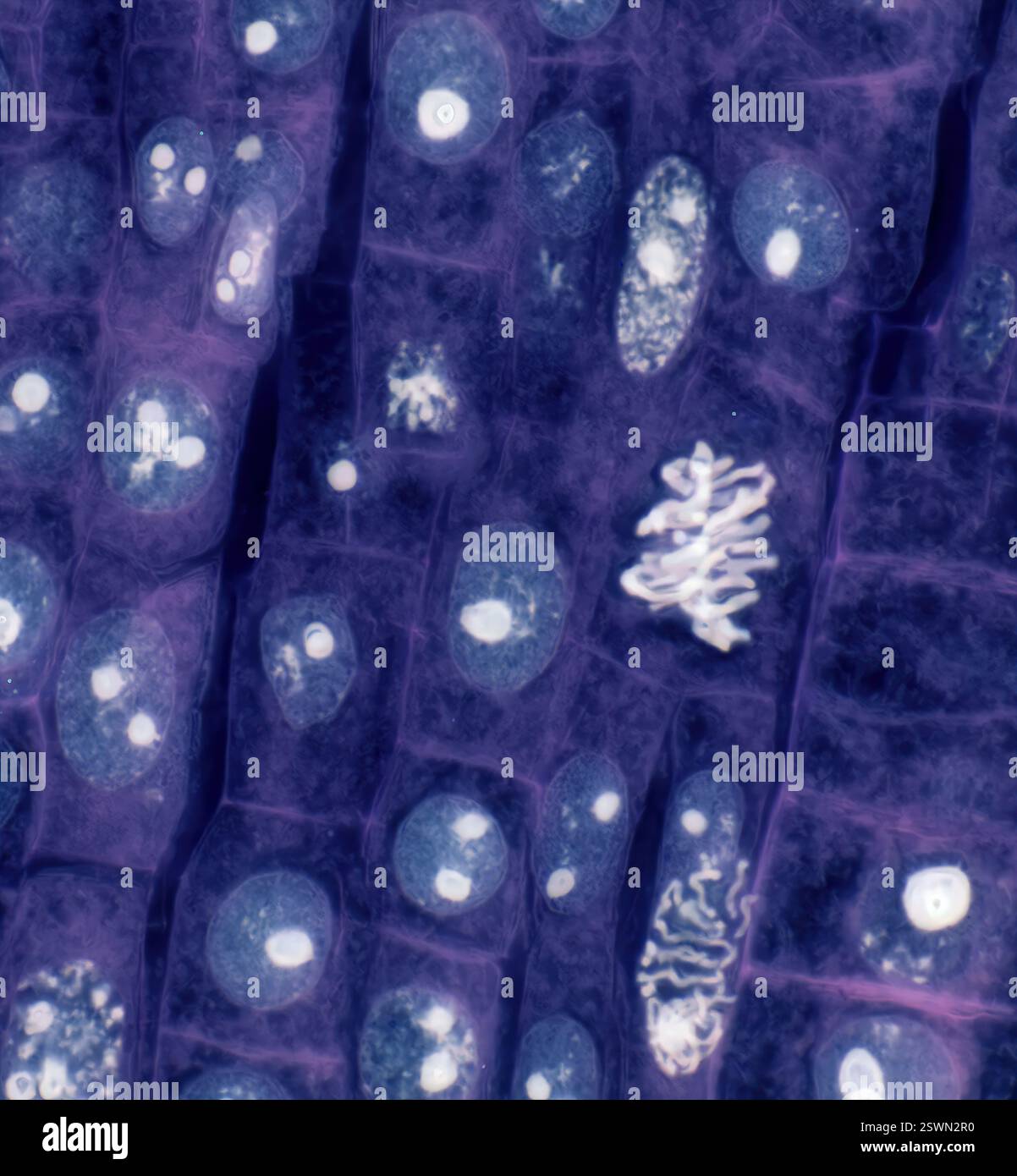 Plant cell mitosis. Light micrograph of root tip cells from an onion ...