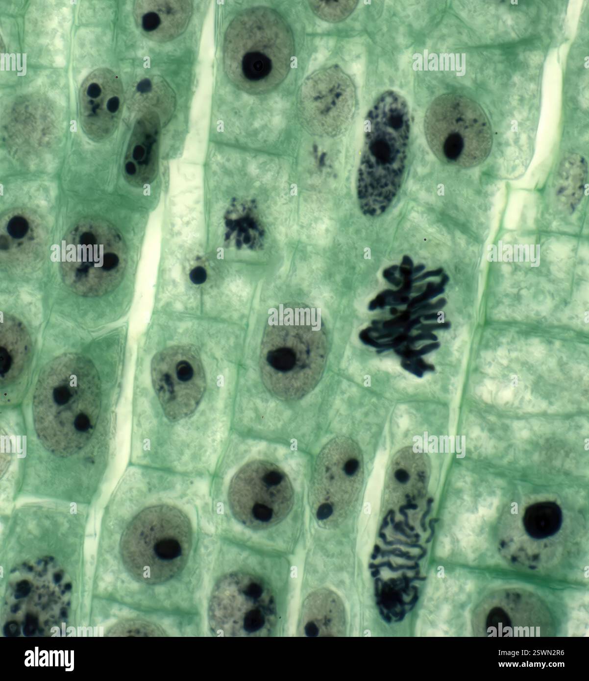 Plant cell mitosis. Light micrograph of root tip cells from an onion ... Plant cell mitosis. Light micrograph of root tip cells from an onion ...