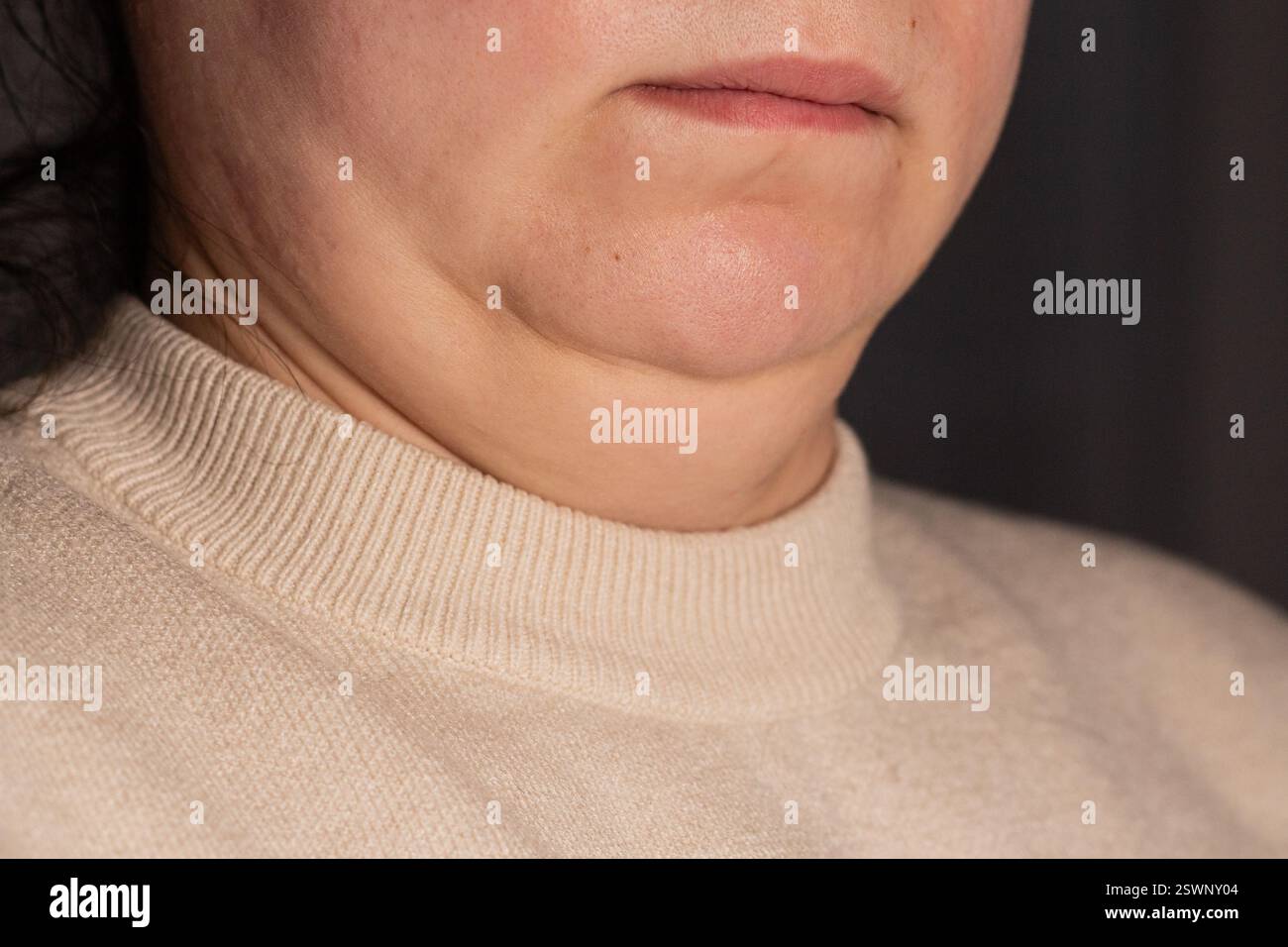 Close up image of female second chin. Overweight woman demonstrating ...