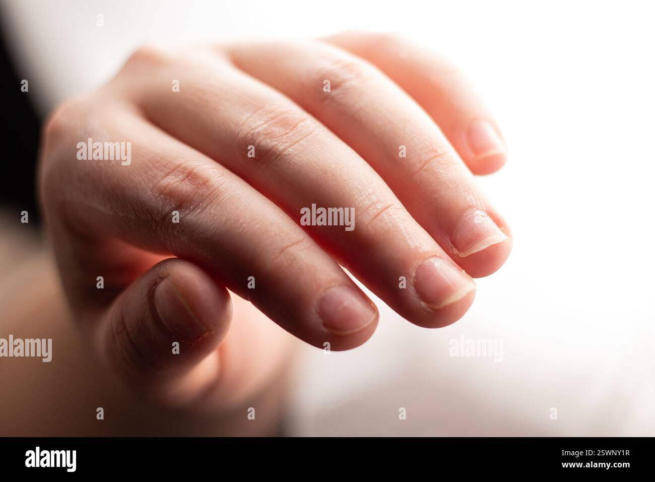 Finger nails bad condition female hi-res stock photography and images ...