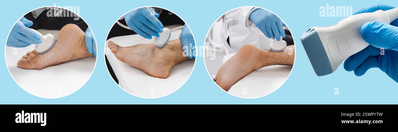 Complex examination of injured patient's foot and ankle joint using ...