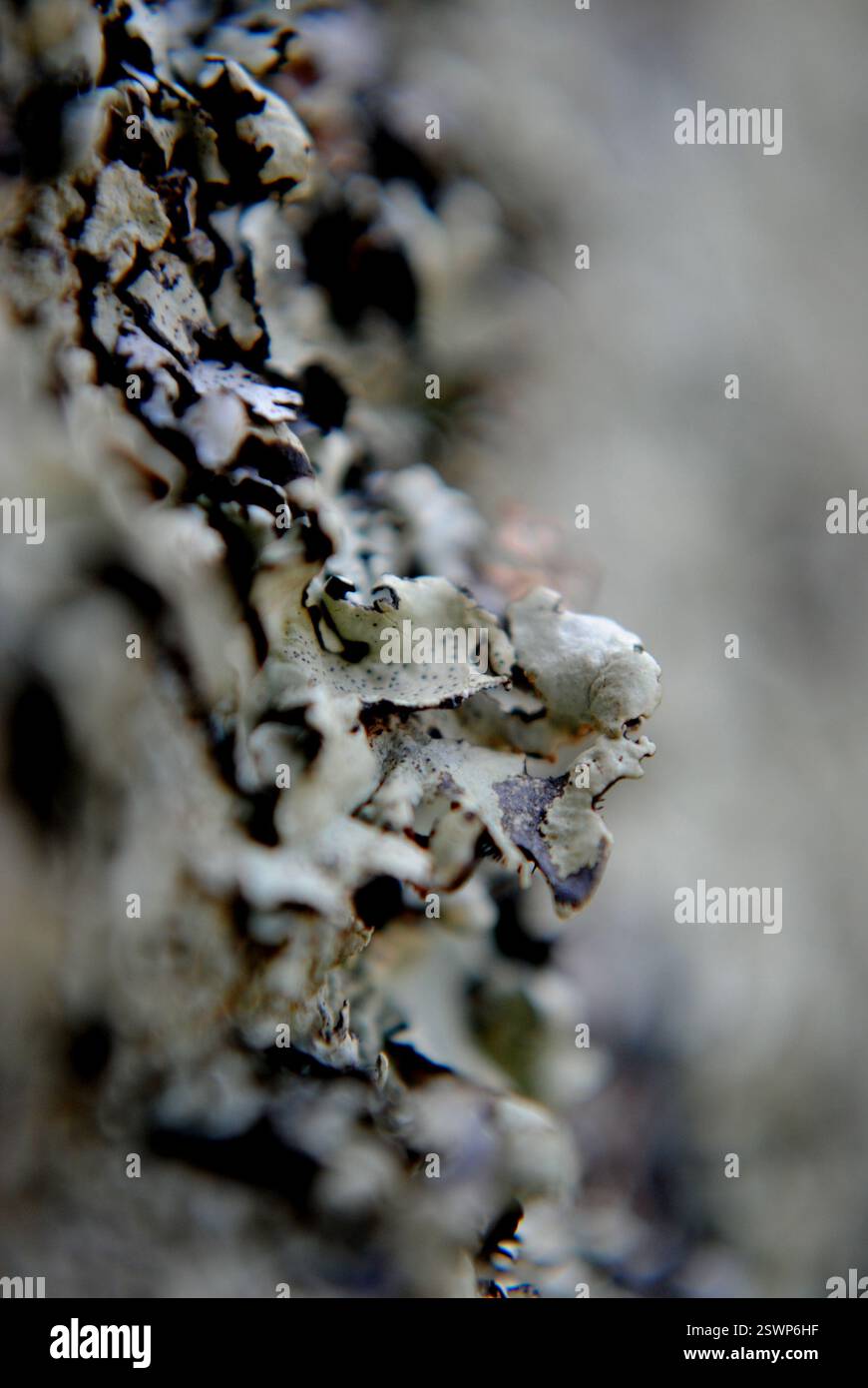 Lichen planus skin disease hi-res stock photography and images - Alamy