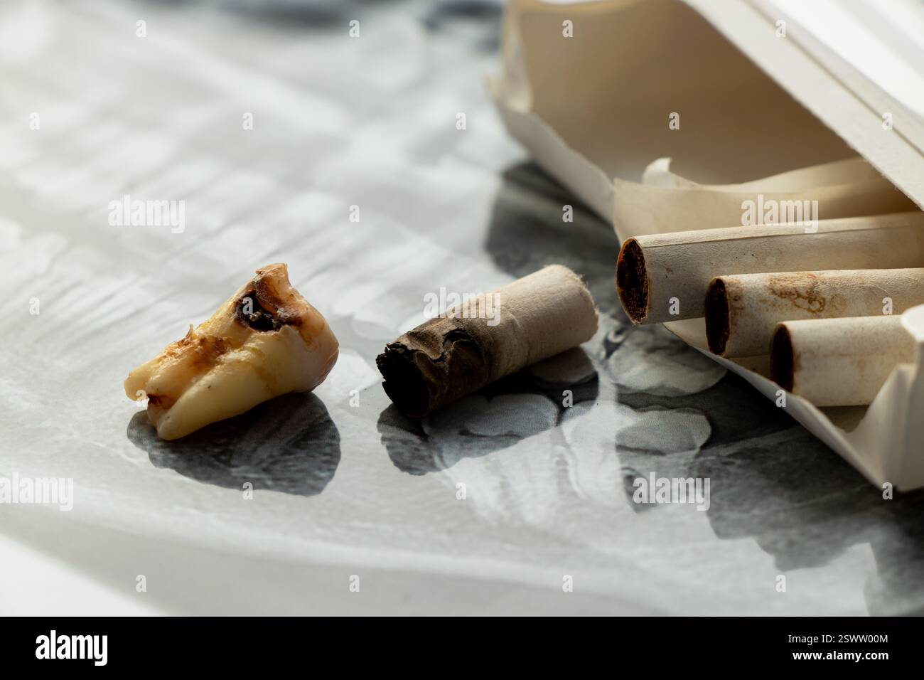 Cigarettes and a black molar pulled out lie on a panoramic dental x-ray ...
