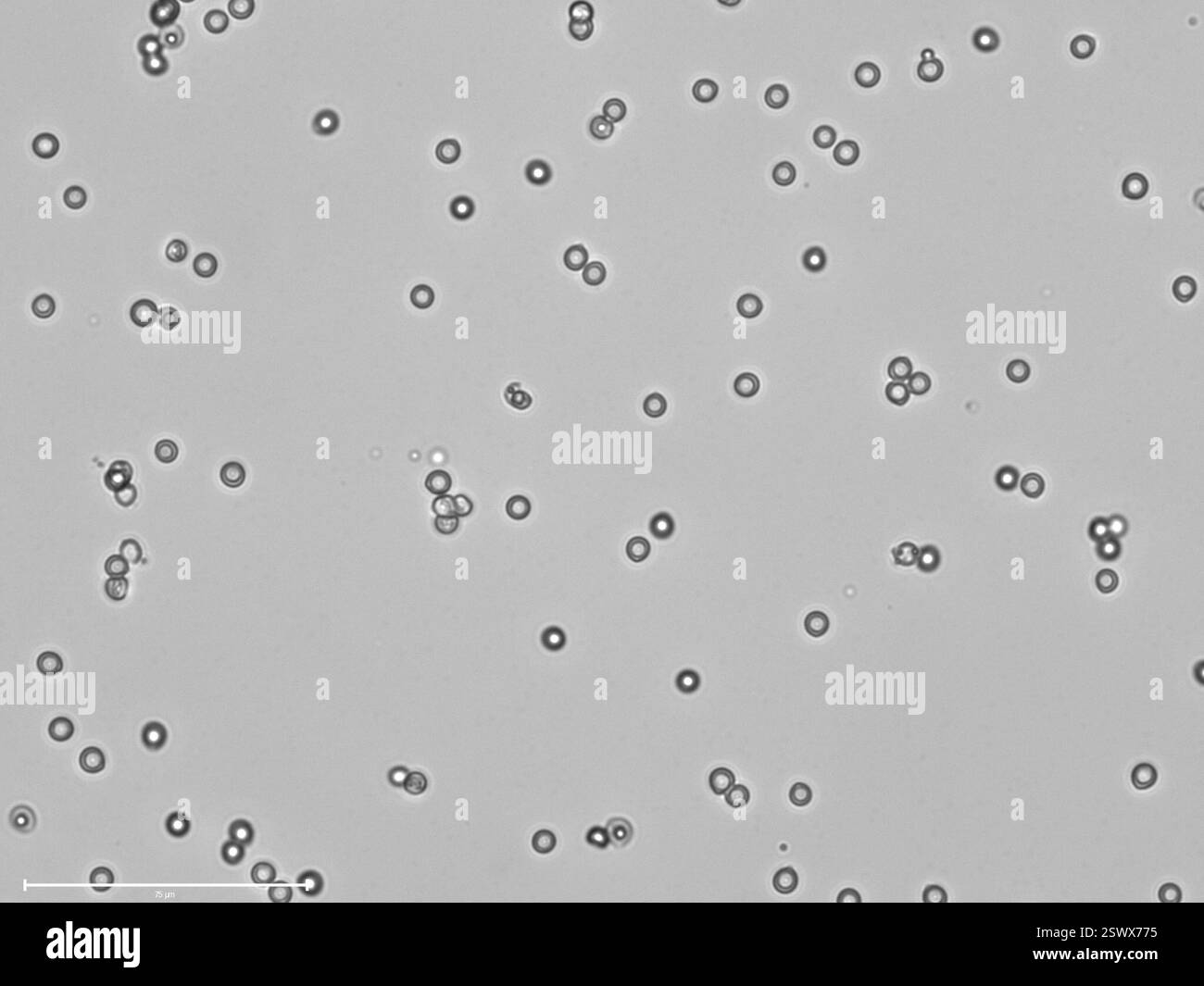 Spherical fungi Black and White Stock Photos & Images - Alamy