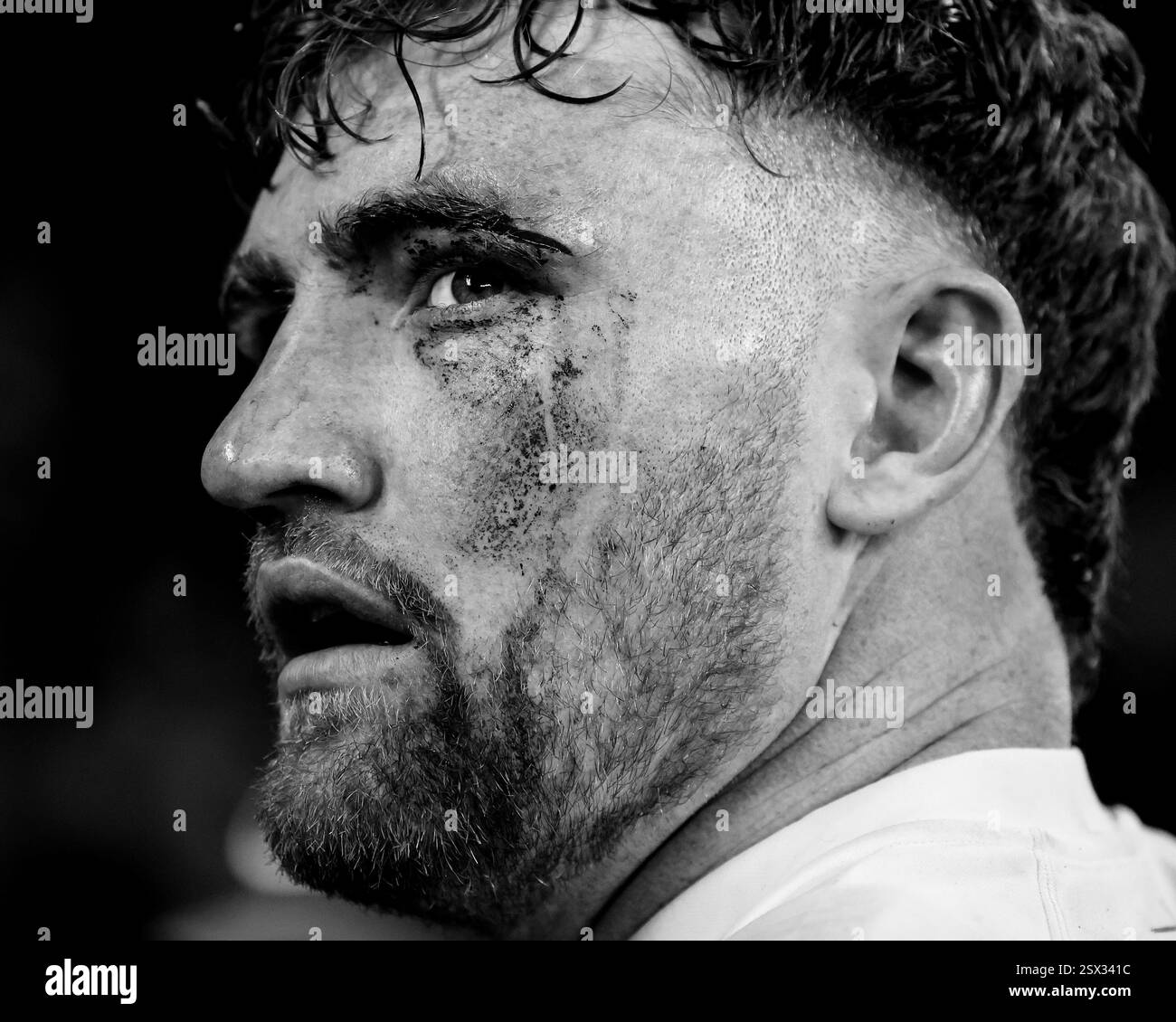 Ollie Chessum of England with a deep laceration to his left eye during ...