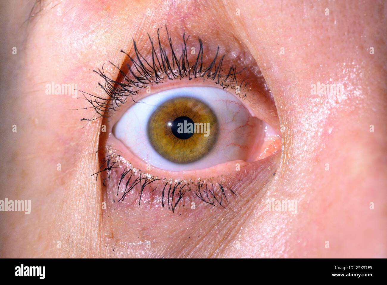 A high-resolution close-up of a human eye with an intense amber and ...