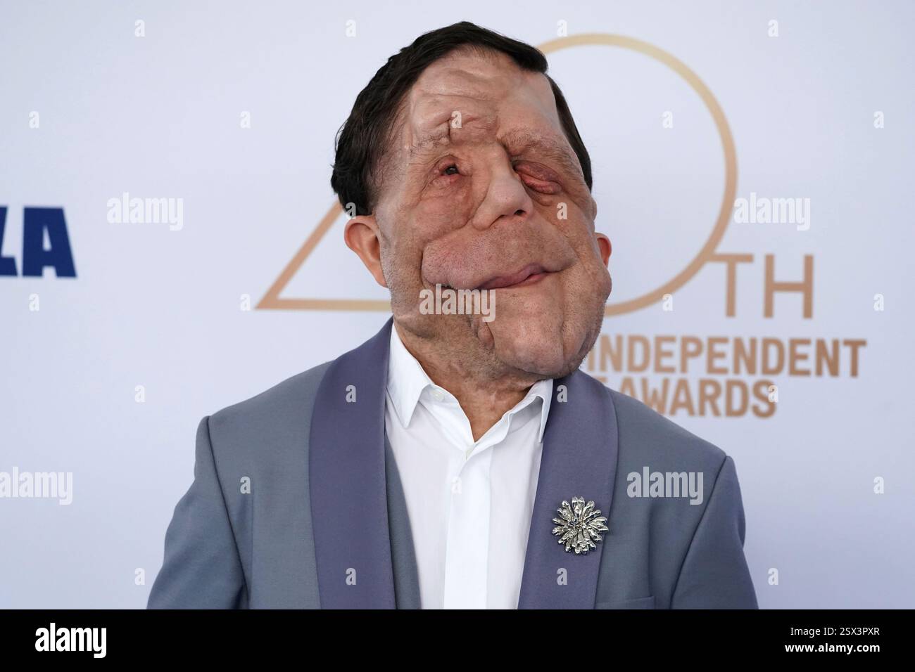Adam Pearson arrives at the Film Independent Spirit Awards on Saturday, Feb. 22, 2025, in Santa ...