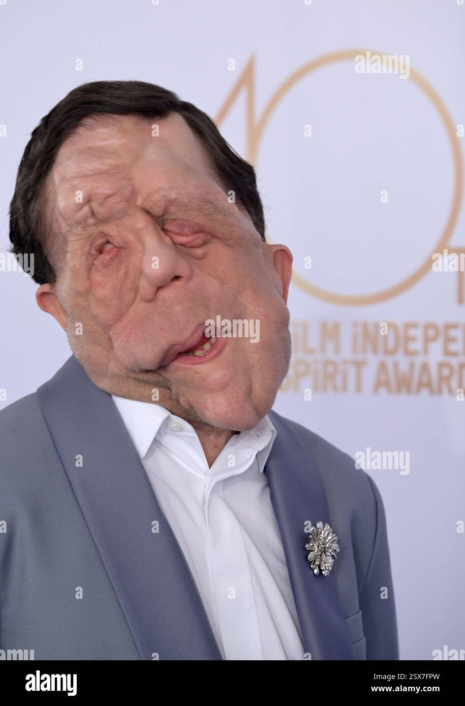 SANTA MONICA, USA. February 22, 2025: Adam Pearson at the 2025 Film ...