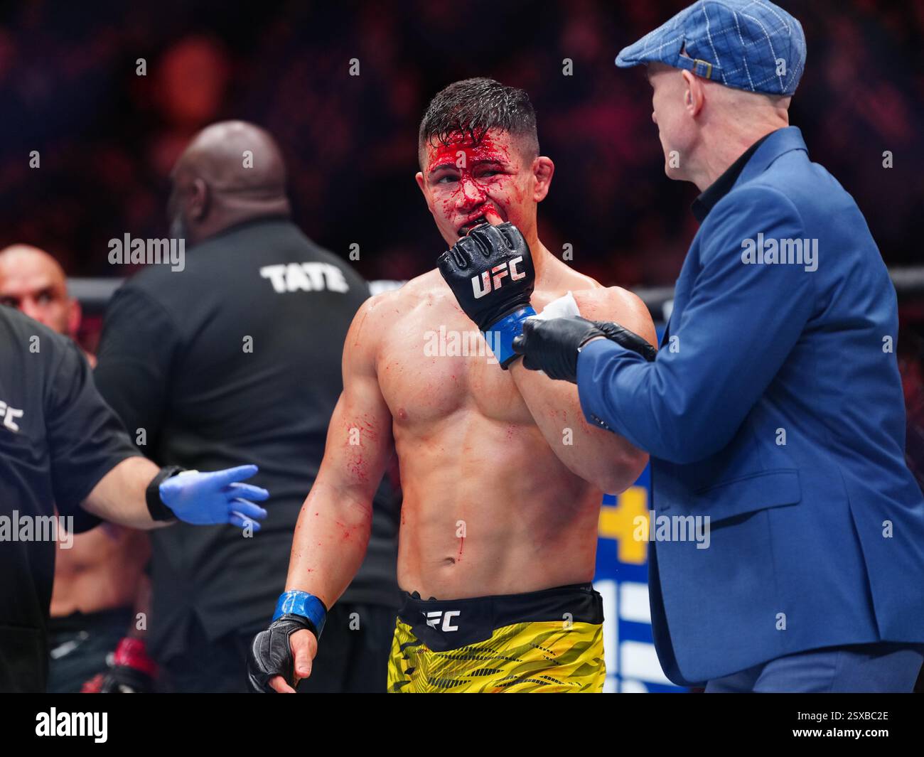 Seattle, Wa, United States. 22nd Feb, 2025. SEATTLE, WA - FEBRUARY 22 ...