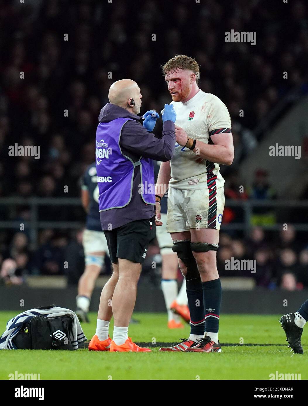 England's Ollie Chessum receives treatment for an injury during the ...