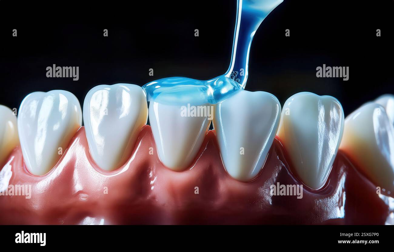A detailed view of dental treatment where a clear gel is applied on ...