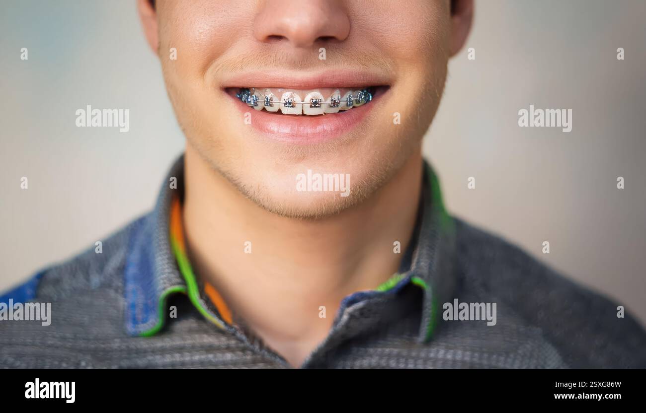 A cheerful teen proudly displays his braces in a bright and welcoming ...