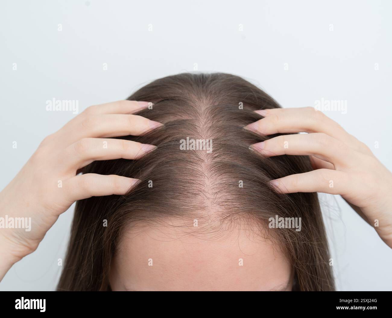 Close up view young woman massaging her scalp with hands stimulating ...