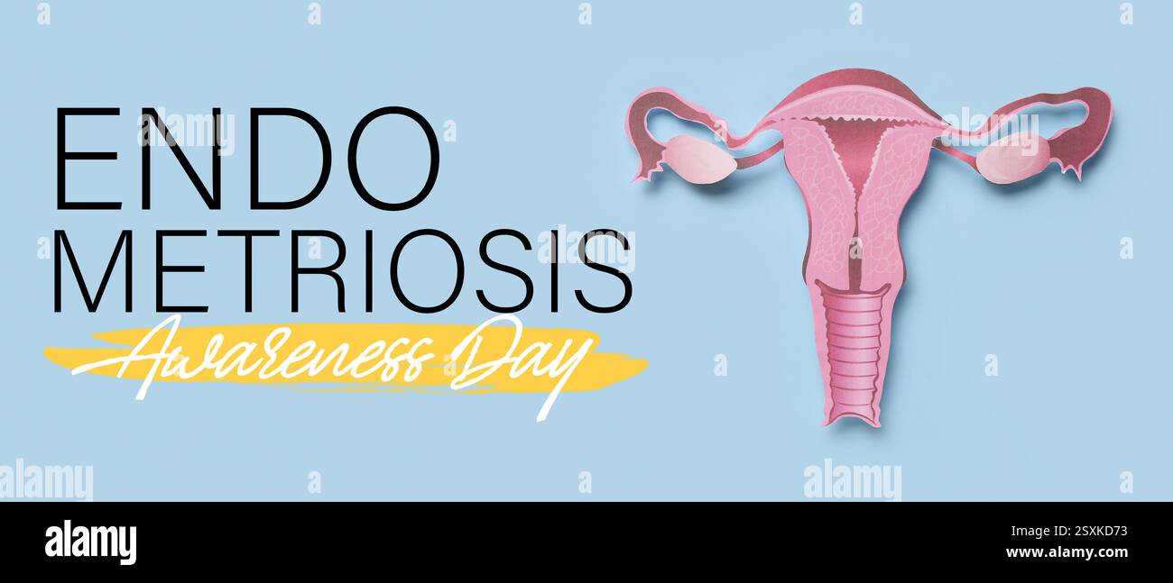 Paper uterus on light blue background. Banner for Endometriosis ...