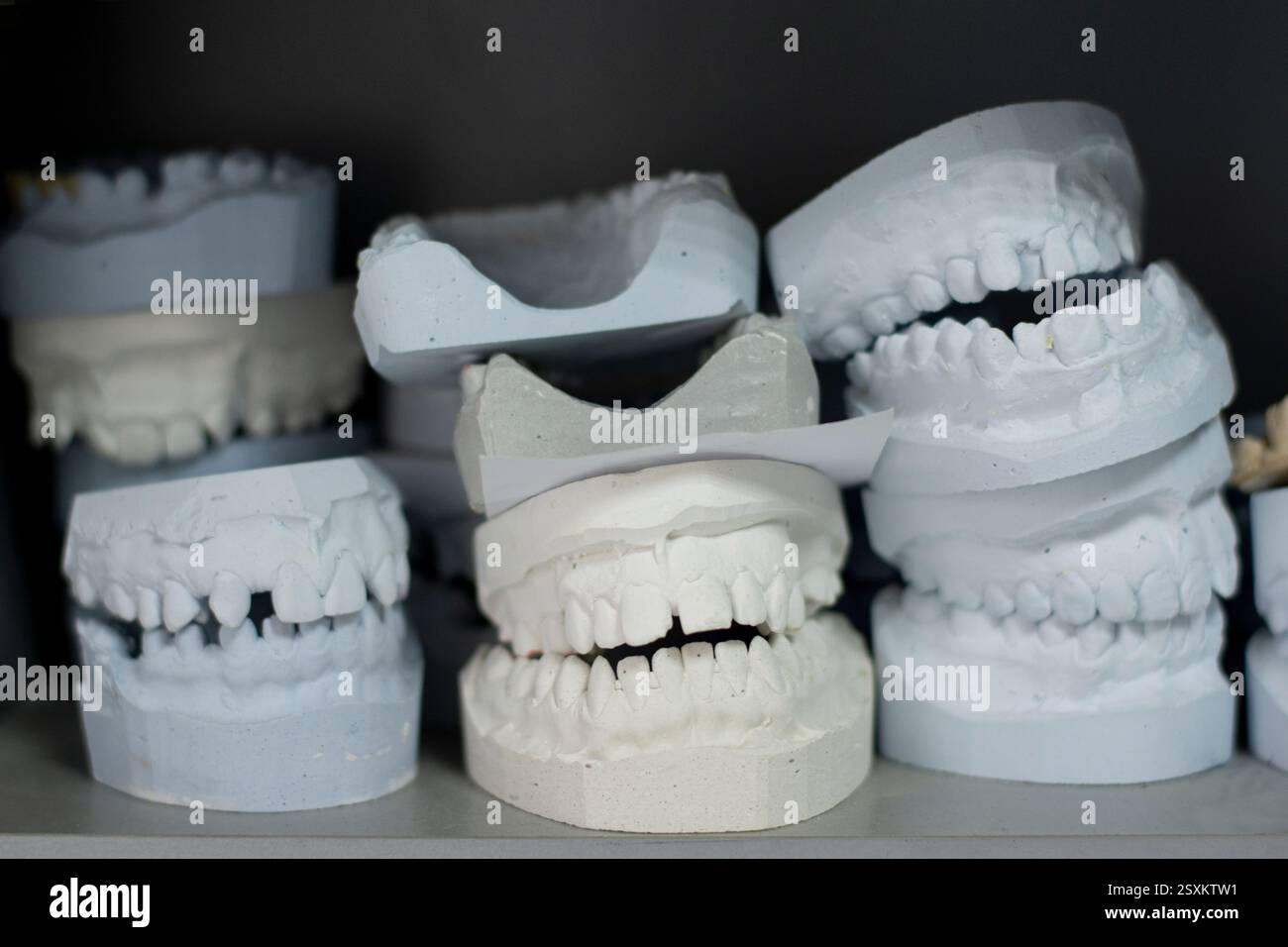 Ortho casts plaster models closeup Stock Photo - Alamy