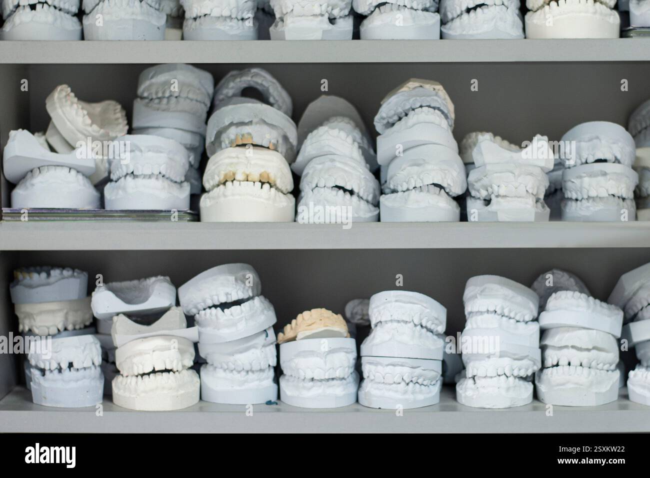 A shelf at dental clinic displaying many plaster casts Stock Photo - Alamy