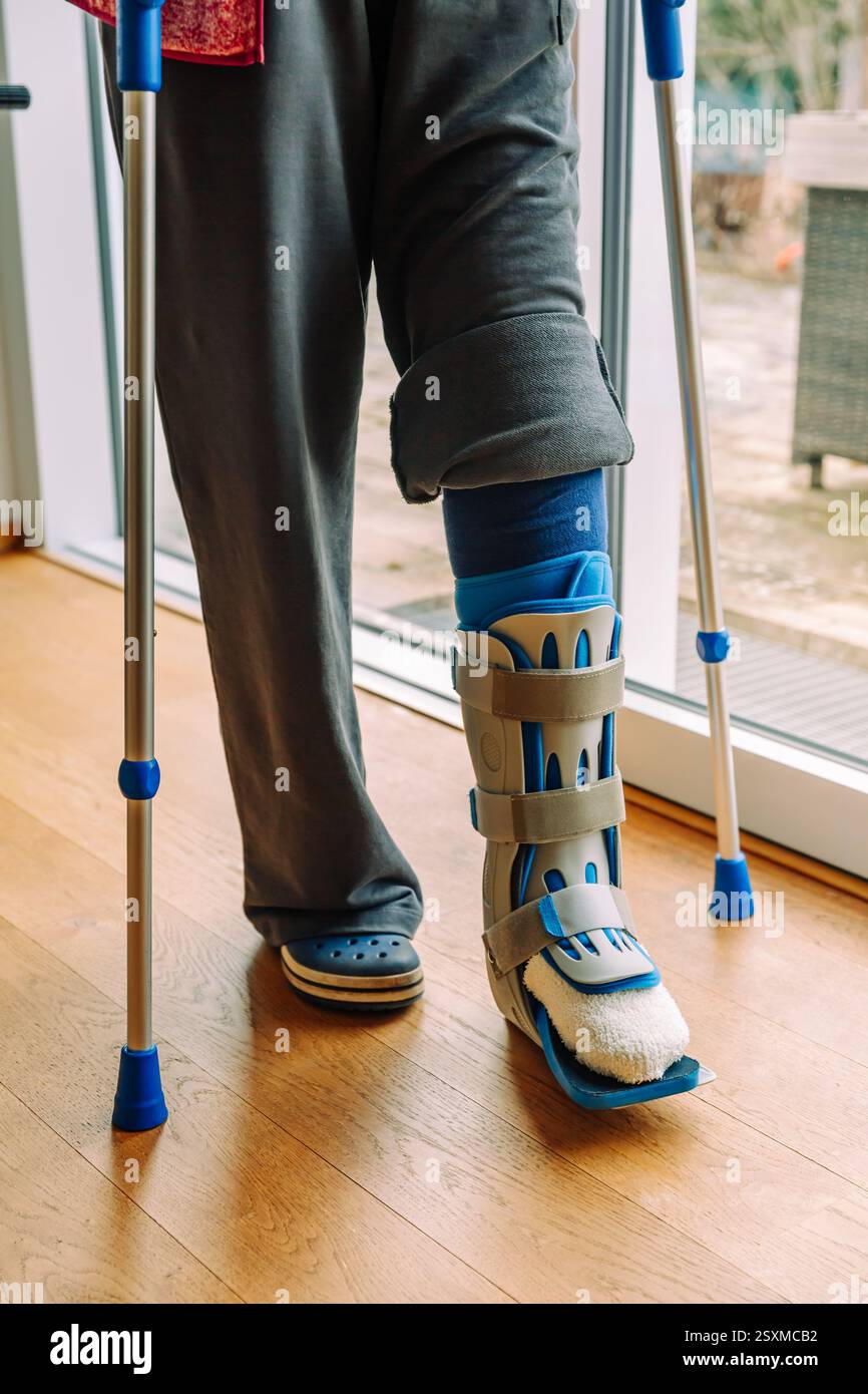 Detail of broken leg or foot injury walking on crutches with leg brace, attaching orthosis or ...