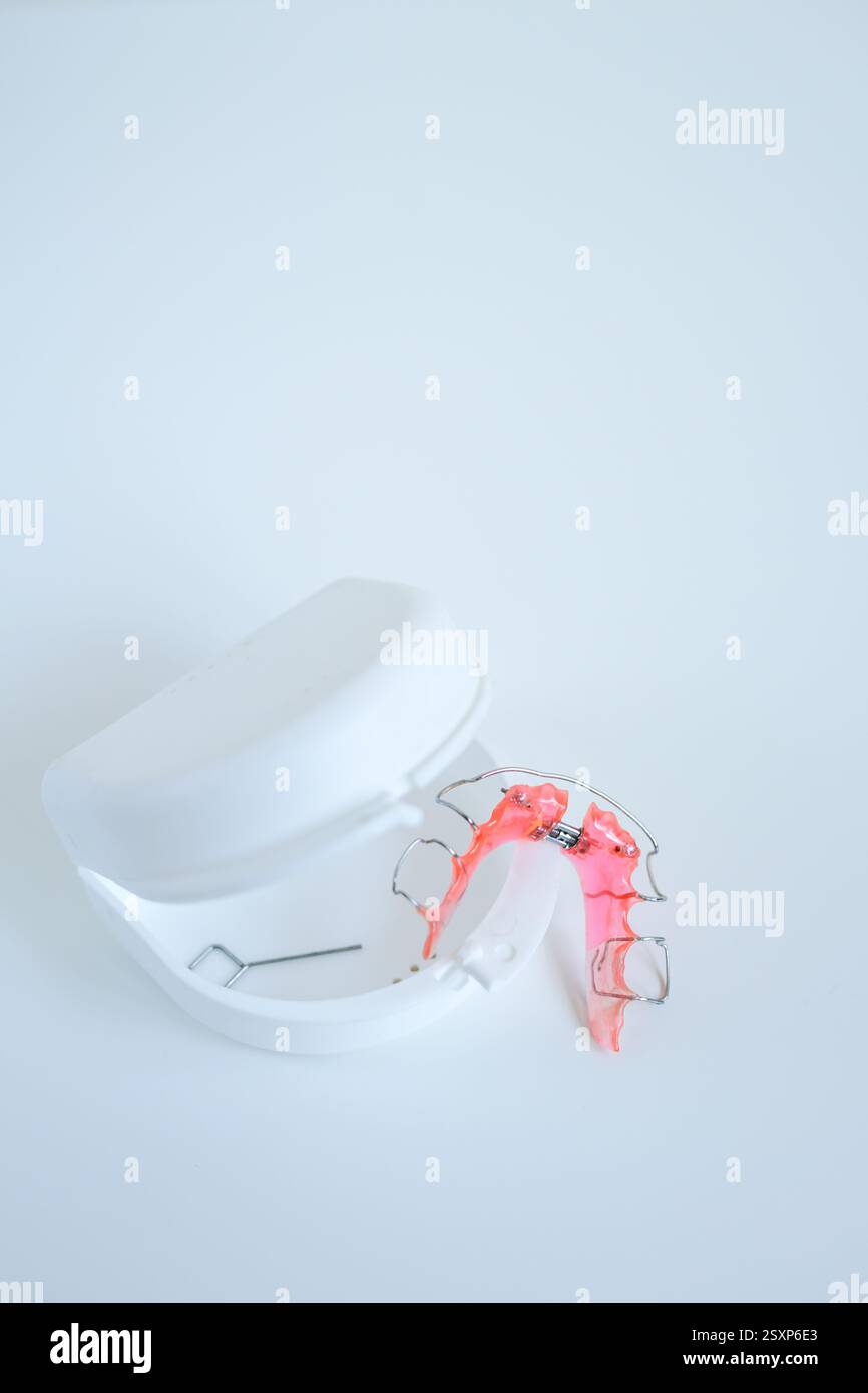 An orthodontic palatal expander with an adjustment key in a white ...