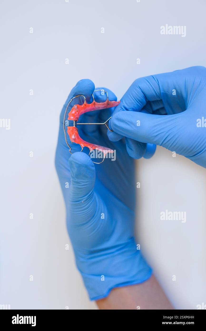 A palatal expander used in orthodontics to widen the upper or lower jaw ...