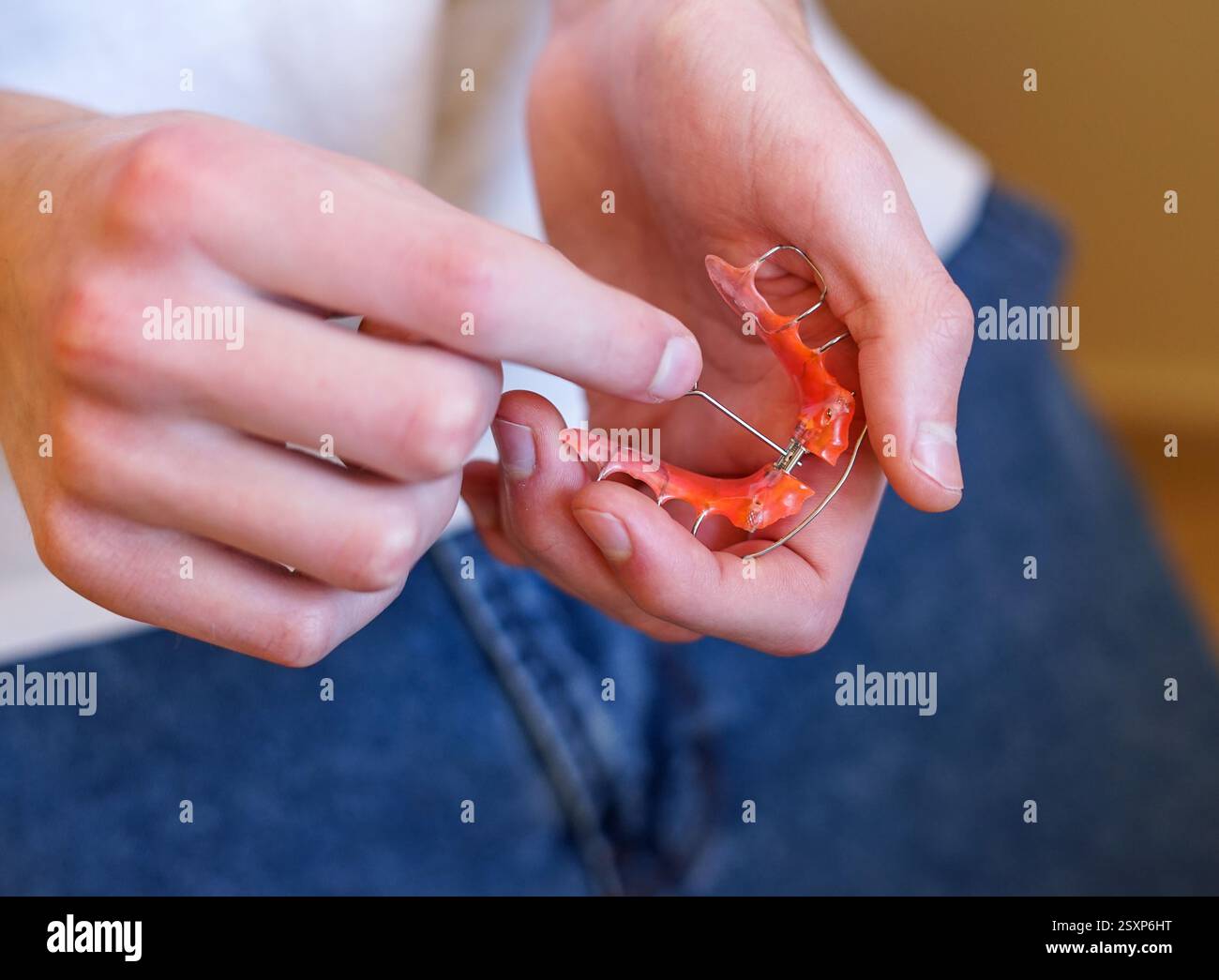 A person adjusting a palatal expander used to widen the upper or lower ...