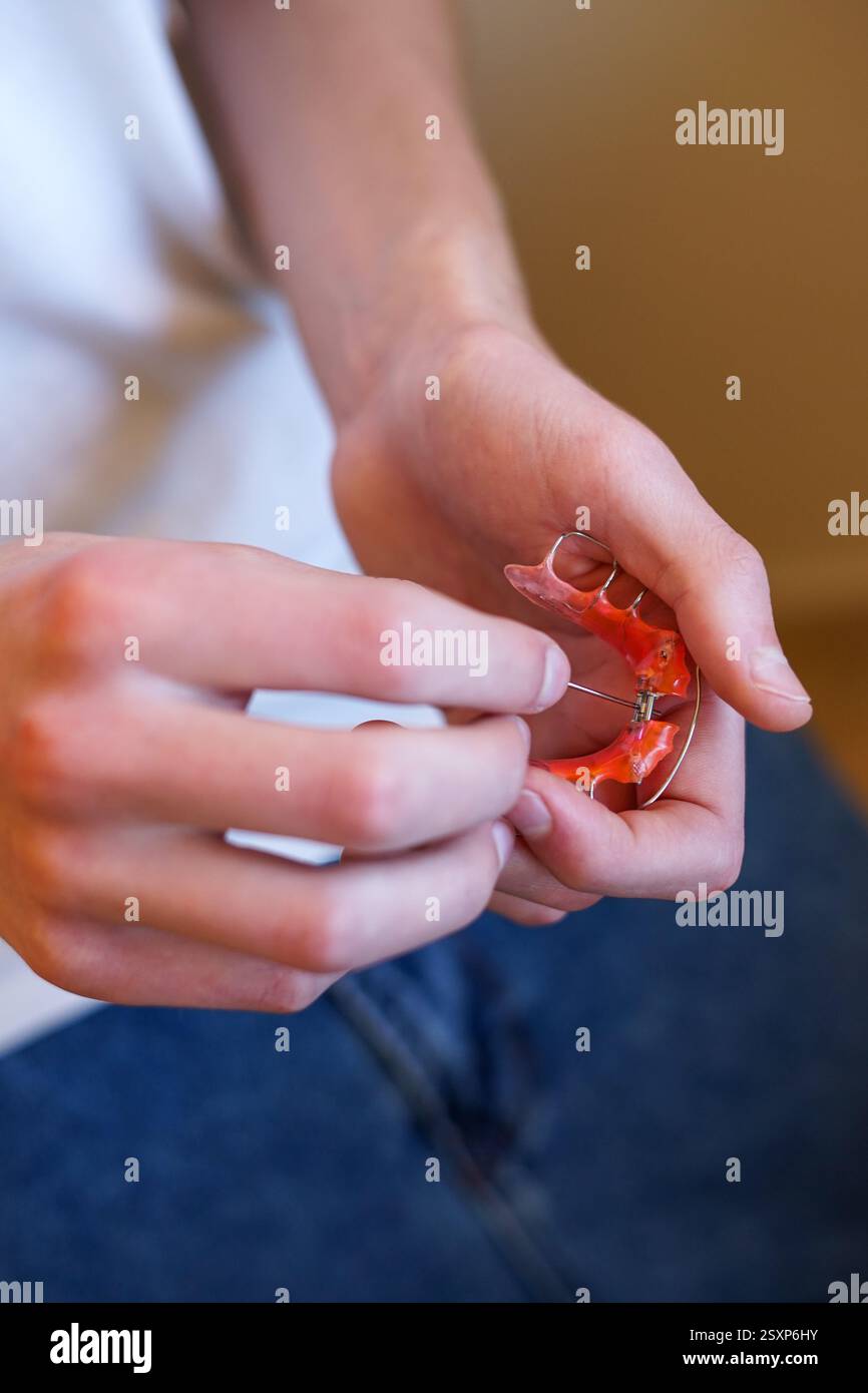 A person adjusting a palatal expander used to widen the upper or lower ...
