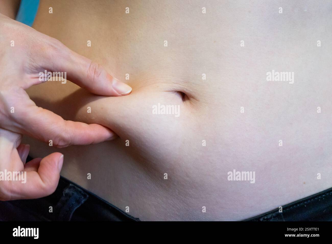 A hand is gently pinching the skin of a person's stomach, highlighting ...