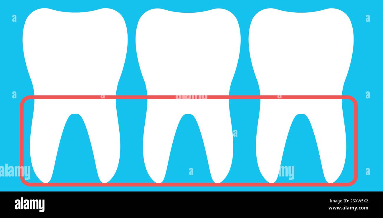 Vector illustration of a row of teeth in the gingiva Stock Vector Image ...
