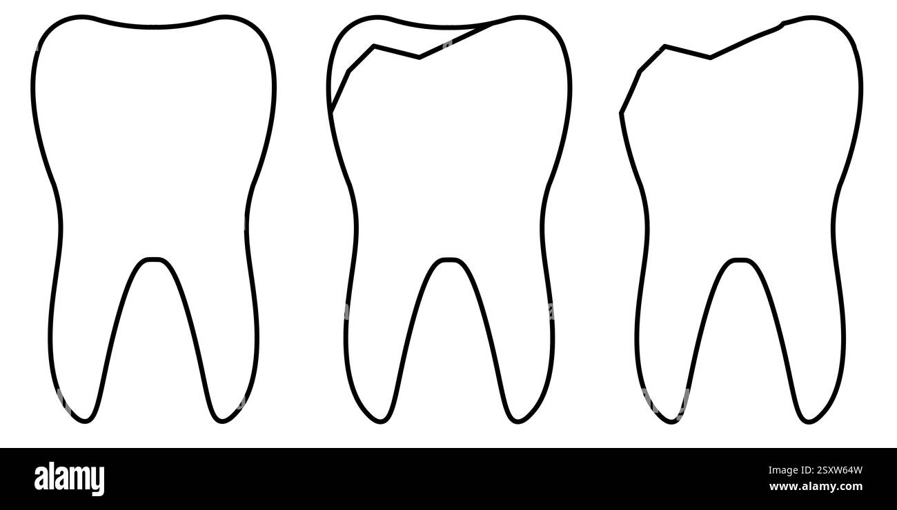 Illustration of Healthy and Damaged Teeth Outlines Showing Dental ...