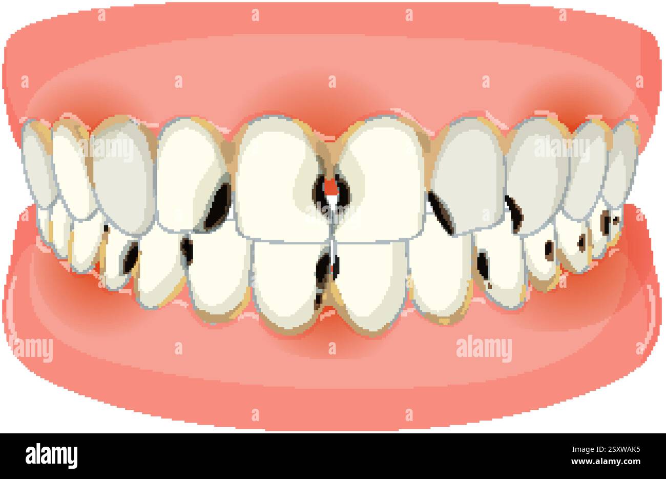Teeth molars incisors Cut Out Stock Images & Pictures - Alamy