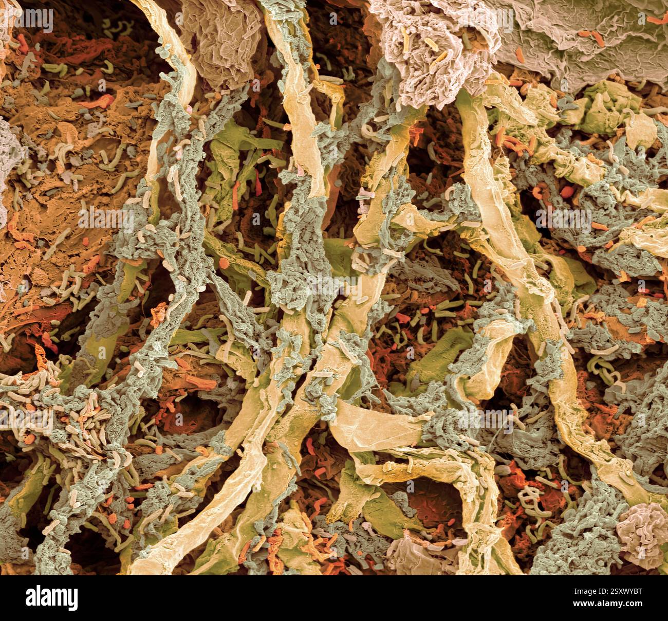Shower waste biofilm. Coloured scanning electron micrograph (SEM) of ...
