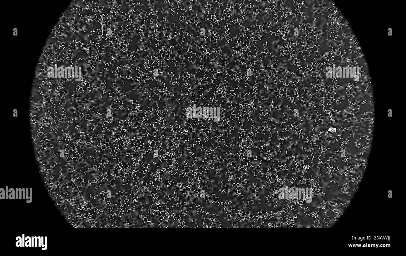 Spirochete bacteria, light micrograph Stock Photo - Alamy